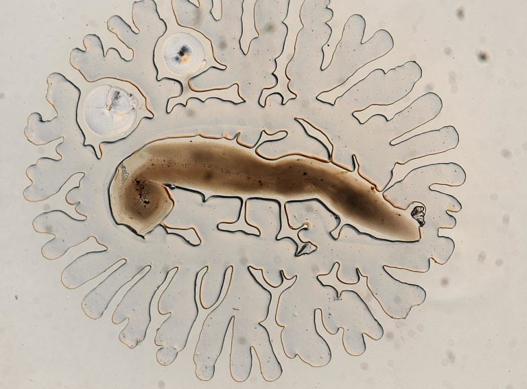 Simptome resimțite în cazul bolii parazitare numite oxiuriază - BodyGeek