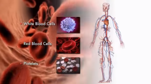 Numărul crescut de globule albe în sânge sau leucocitoza – simptome ...